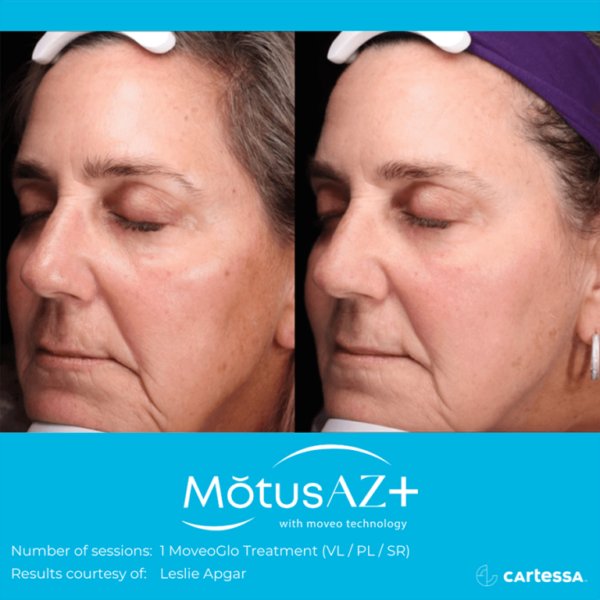 Motus AZ + NYC - Info, Reviews, Photos | Near Me Plastic Surgery